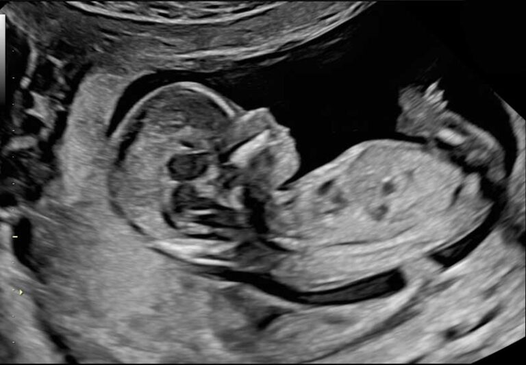 Praktijk Viev. Verloskunde, echocentrum, kinderwens, anticonceptie